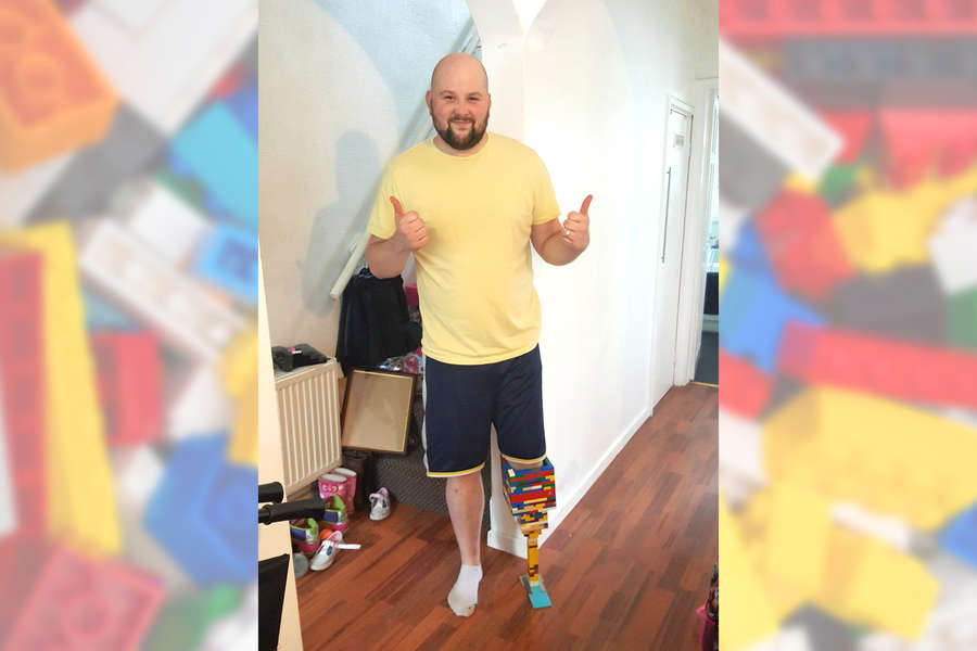 Using Lego Pieces, Man Builds His Own Prosthetic Leg - Thrillist
