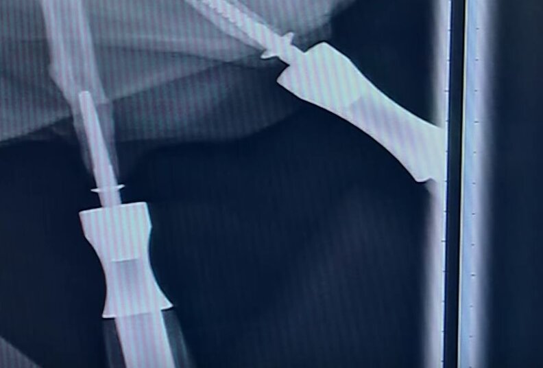 Cat Walks For The Very First Time, Thanks To New Prosthetic Legs - The Dodo