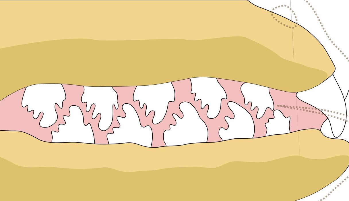 7 Sets Of Teeth That An Orthodontist Would Love - The Dodo