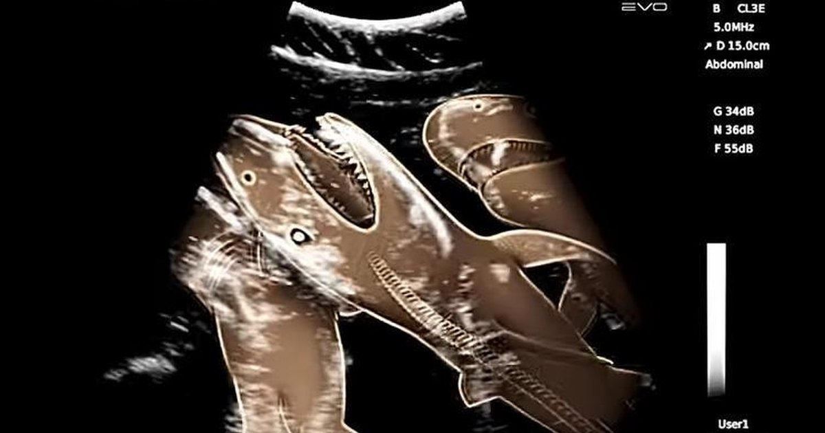 World's First Tiger Shark Ultrasound Reveals SO MANY Babies - The Dodo
