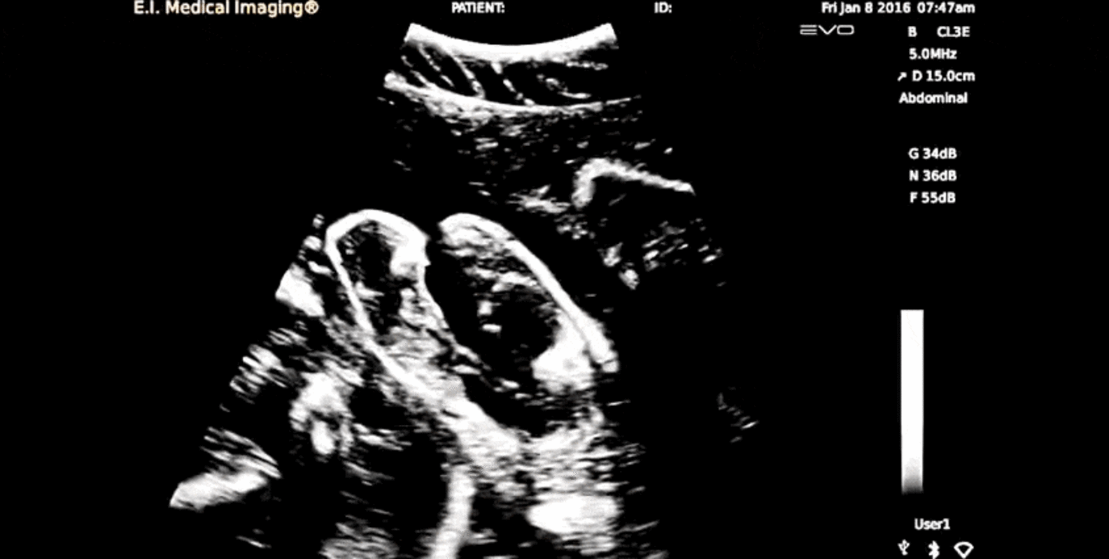 World's First Tiger Shark Ultrasound Reveals SO MANY Babies - The Dodo