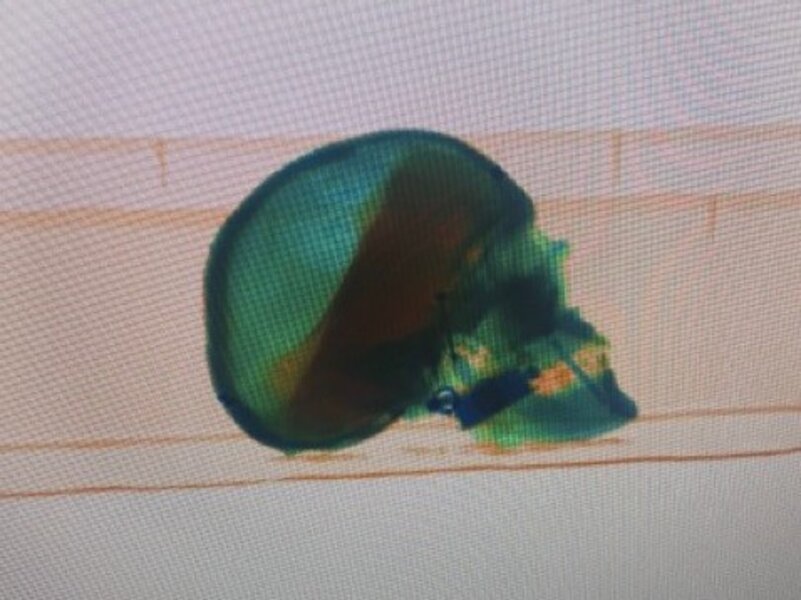 TSA Found a Skull Inside a Suitcase at the Salt Lake City Airport ...