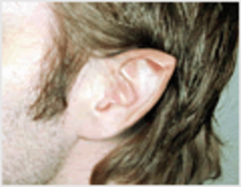 Faun Ears - Own - Thrillist New York