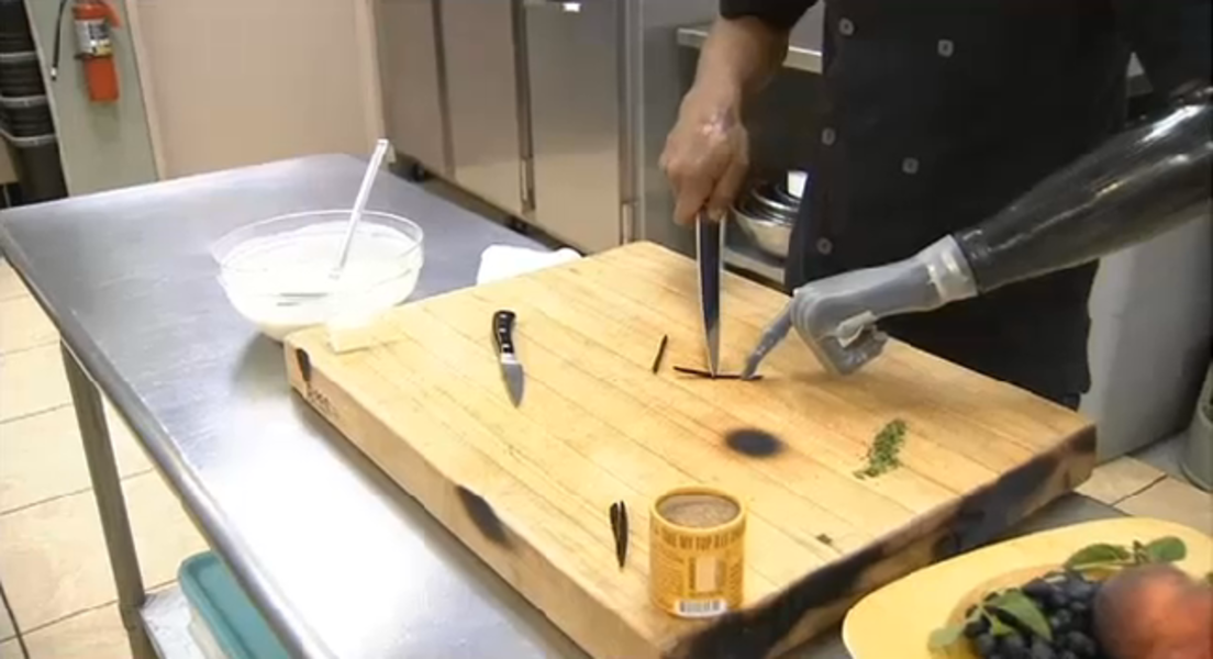 Chef and mountain man serves up food with the help of a bionic hand ...